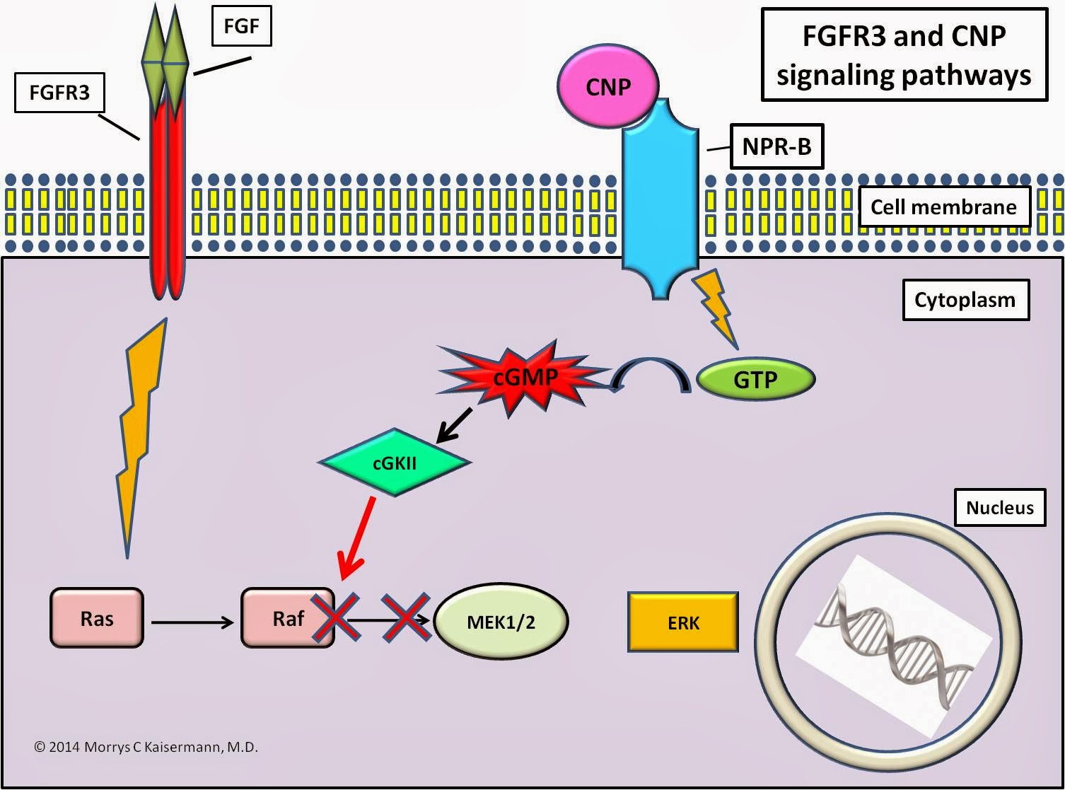 Treating Achondroplasia: Tratando la acondroplasia: TransCon CNP mostró ...