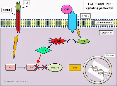 Treating Achondroplasia: Treating achondroplasia: TransCon CNP showed ...