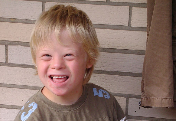 Down Syndrome Symptoms What Is Down Syndrome Health And Beauty down-syndrome-symptoms-what-is-down-syndrome-health-and-beauty