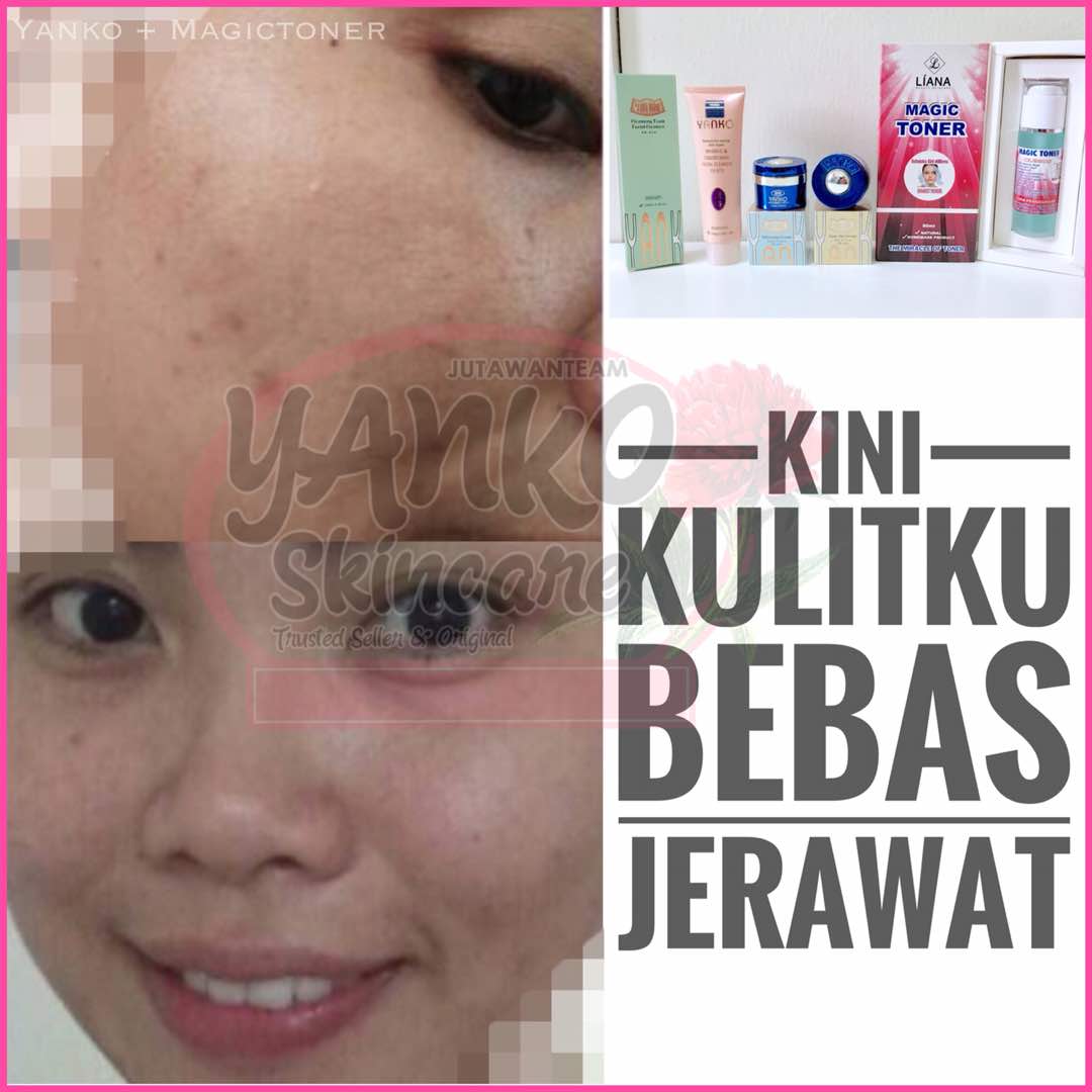 YANKO SKINCARE MALAYSIA