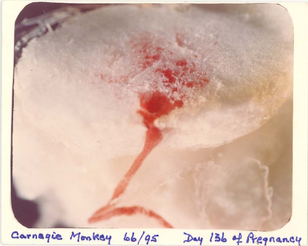 The Evolving Placenta: Elizabeth Maplesden Ramsey