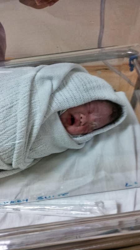 Sticky Bean's Birth Story at 34 weeks - Premature Baby