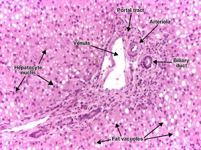 Histology and Explanation of Fatty change or Steatosis In Liver ...