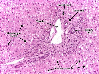 Histology and Explanation of Fatty change or Steatosis In Liver ...