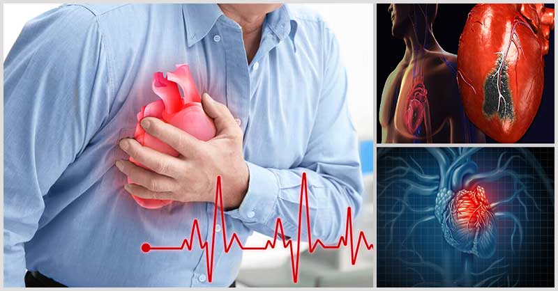 Important Things You Must Do After A Minor Heart Attack | Dr Farrah MD