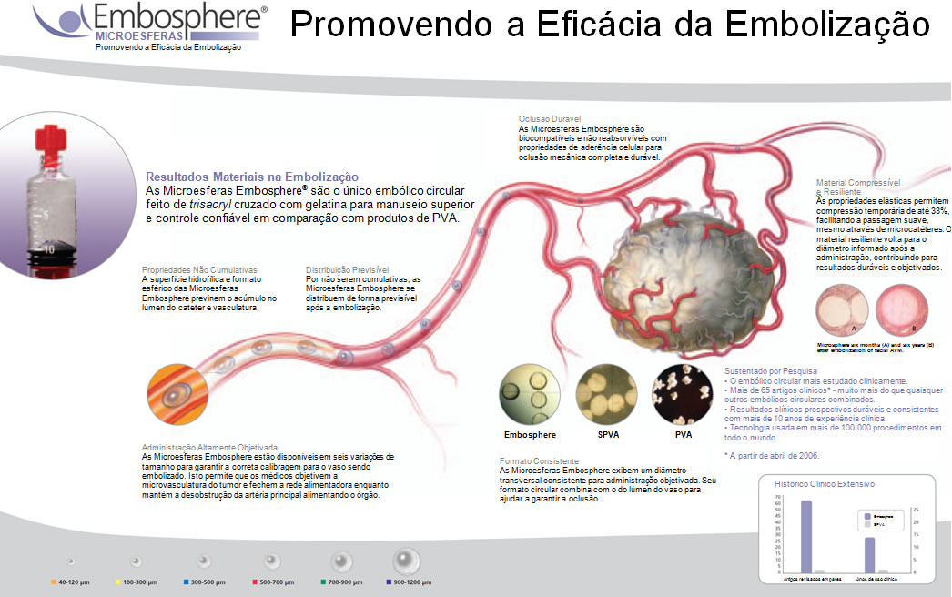 Embosphere Microesferas para tratar próstata aumentada é aprovado na Europa
