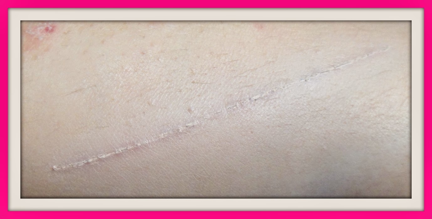 Review: Boo-Boo Cover Up - Heal While you Conceal - Must Be...Pink!