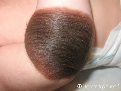 Dermapixel: octubre 2011