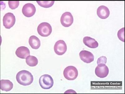 FICHERO DE HEMATOLOGIA: CODOCITOS