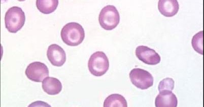 FICHERO DE HEMATOLOGIA: CODOCITOS