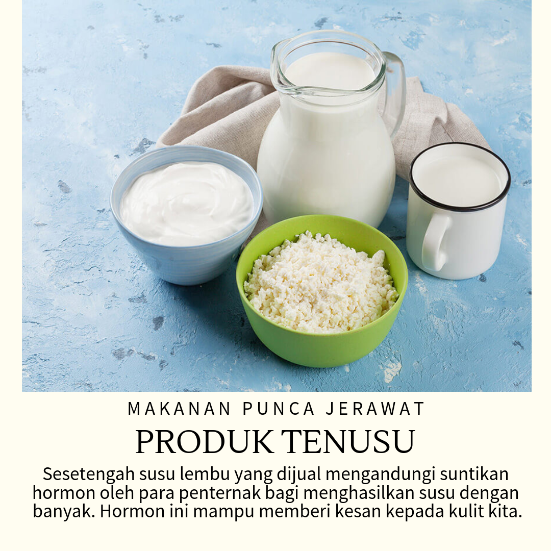 7 Makanan Punca Jerawat