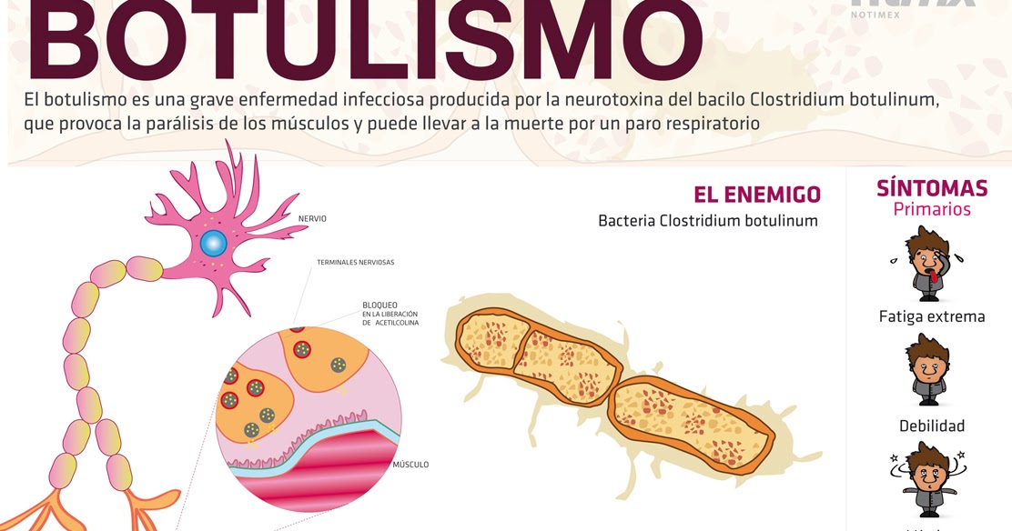 B.R.E.A. VENENOS: -Botulismo (Clostridium botulinum)