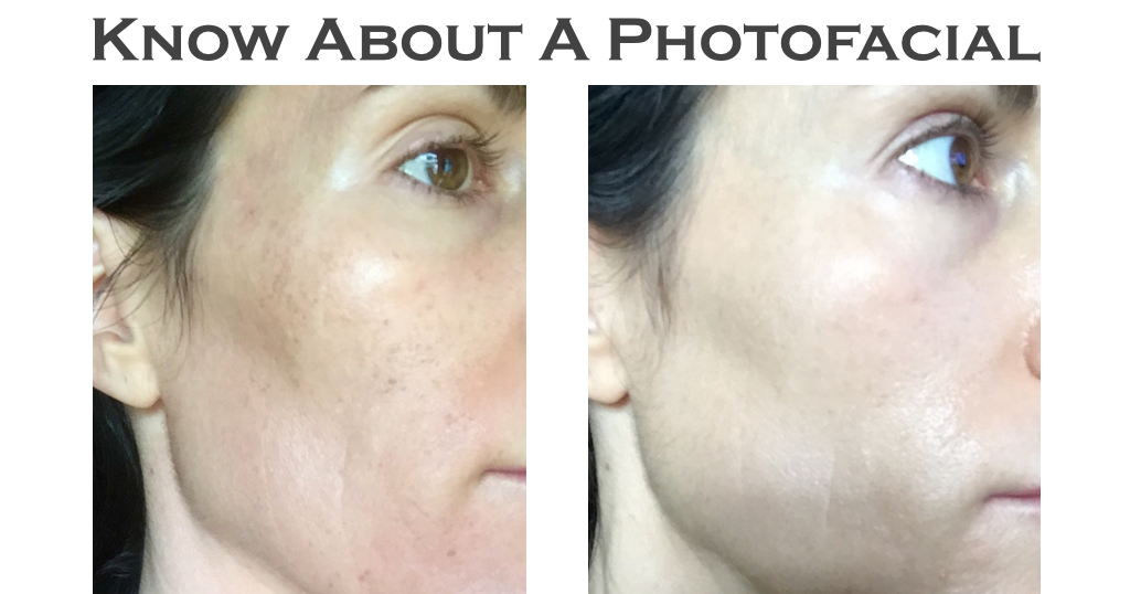 Photofacial Review: Everything You Need To Know About This Gamechanging ...