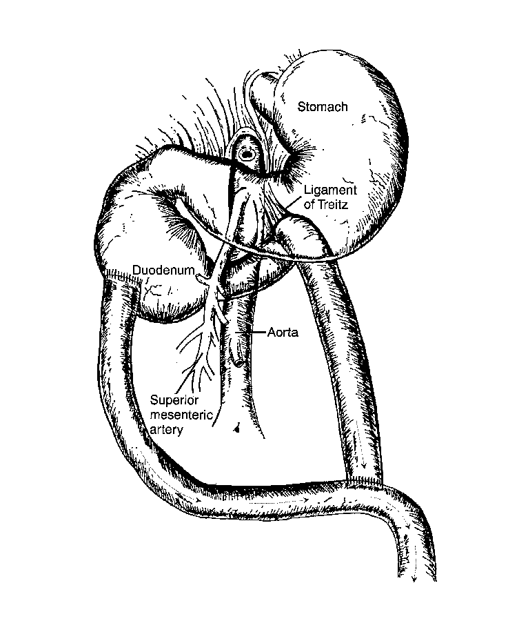 Our Dynamic Life: Superior Mesenteric Artery Syndrome (SMAS)
