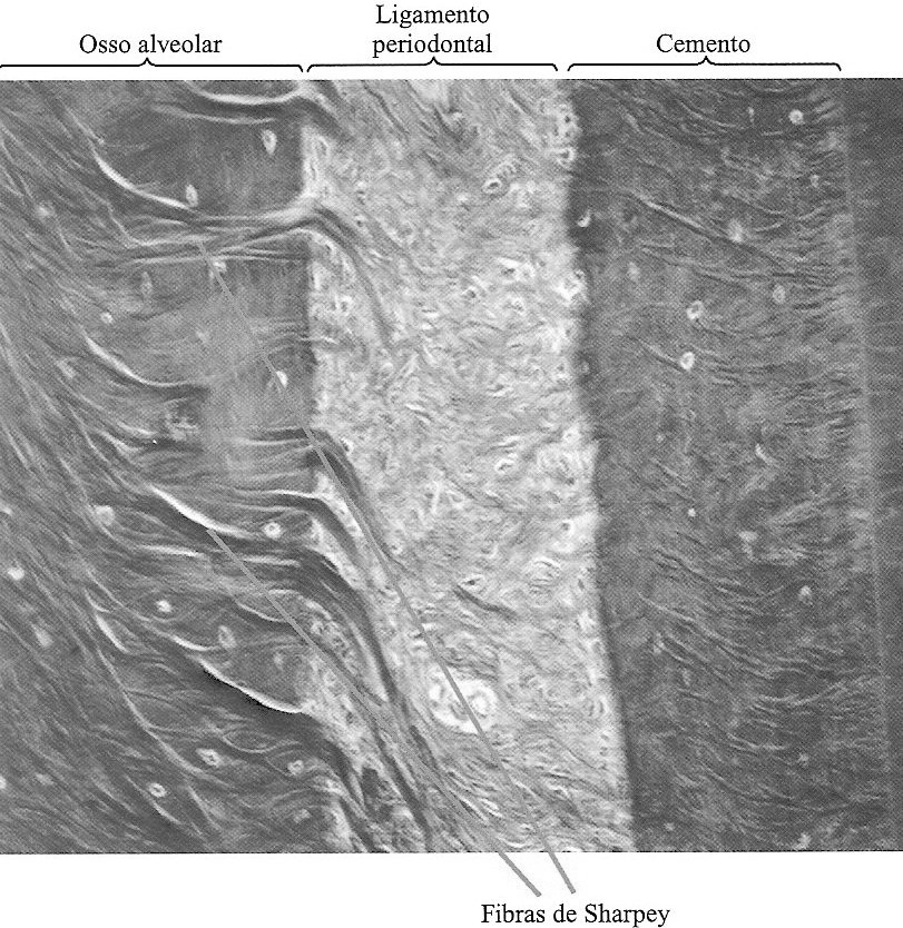 ESTUDONTO: Histologia do periodonto de inserção