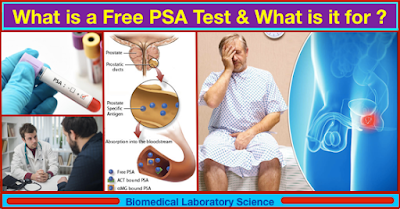This article examines when a free PSA test is used, how it differs from ...