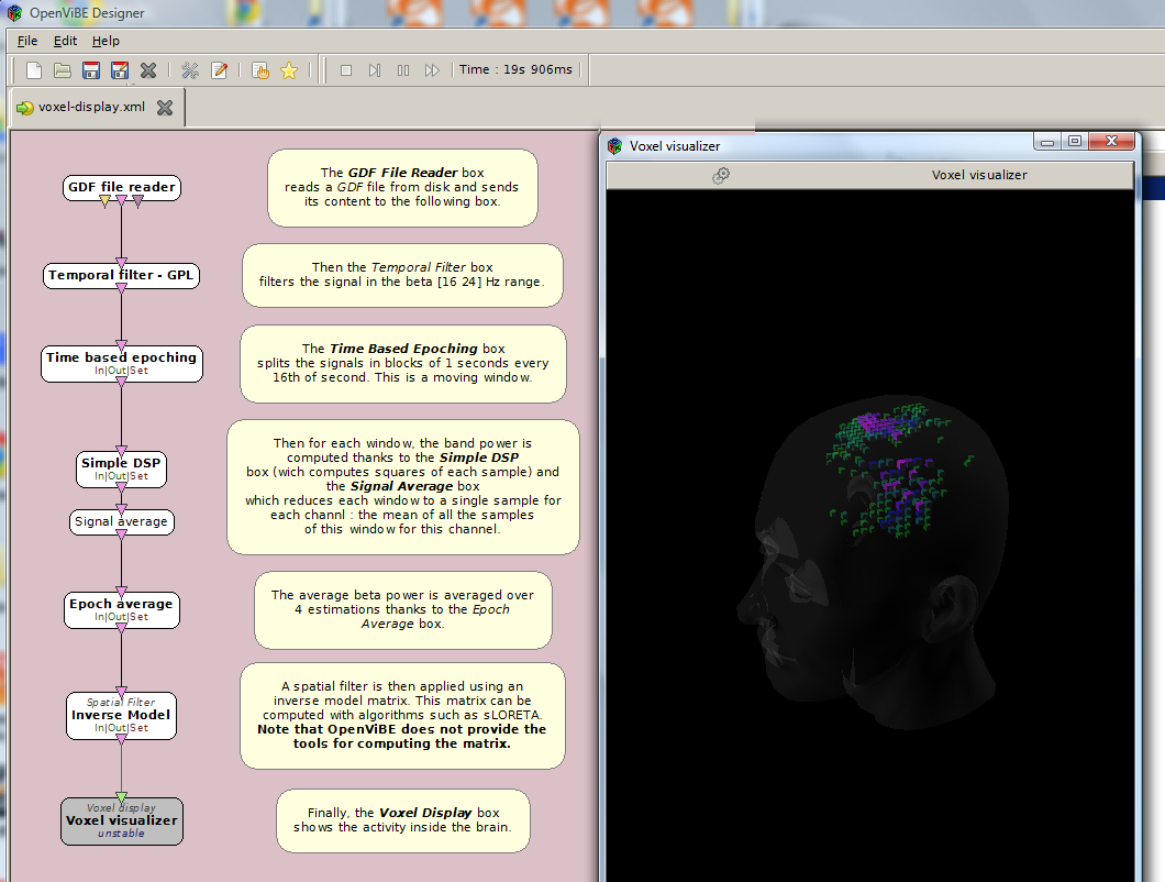 BRAIN-COMPUTER INTERFACES over EEG: OpenVibe 3D Voxel and Topographic Map