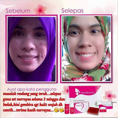 NURRAYSA BEAUTY SKINCARE SET MURAH | Eryna Beauty Shop