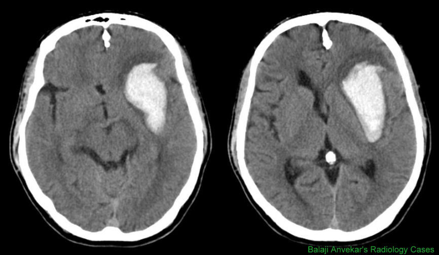 Dr Balaji Anvekar FRCR: 01/09/2011 - 01/10/2011