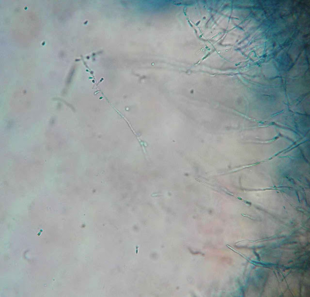 ATLAS MICOLOGIA: TRICHOPHYTON INTERDIGITALE