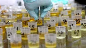 Ingin Berbagi Ilmu dan Pengalaman: CARA MEMBACA HASIL TES URINE LENGKAP!