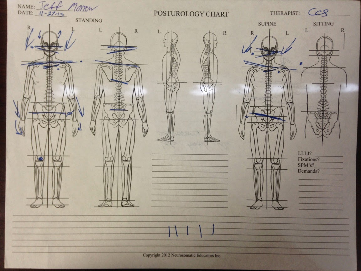 Posturology Of A Stroke Victim Sarasota Pain Treatment Center posturology-of-a-stroke-victim-sarasota-pain-treatment-center