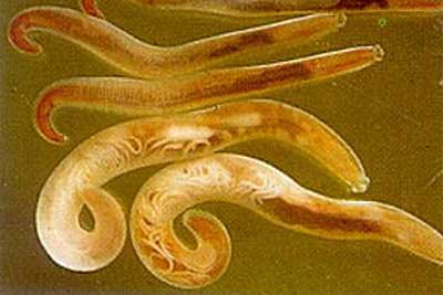 Couple eaten alive by parasitic worms