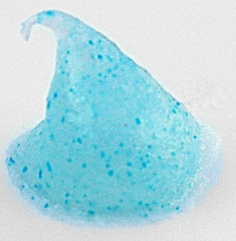 Dentist Houston Texas