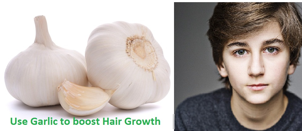 HEALTHY START: Use Garlic to boost Hair Growth