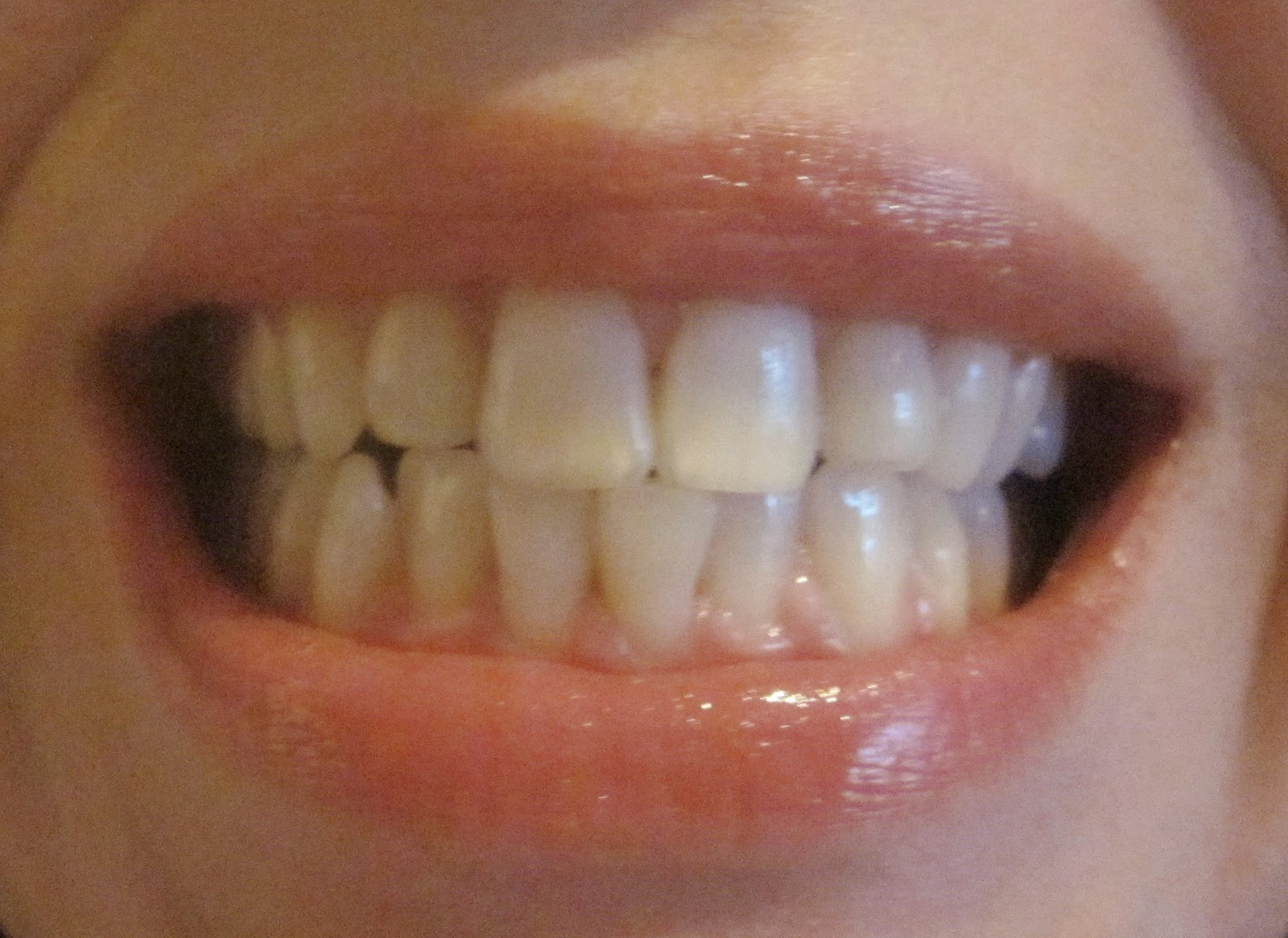 Jessica Jean Myers: Whitening Lightning - Tooth Whitening Review