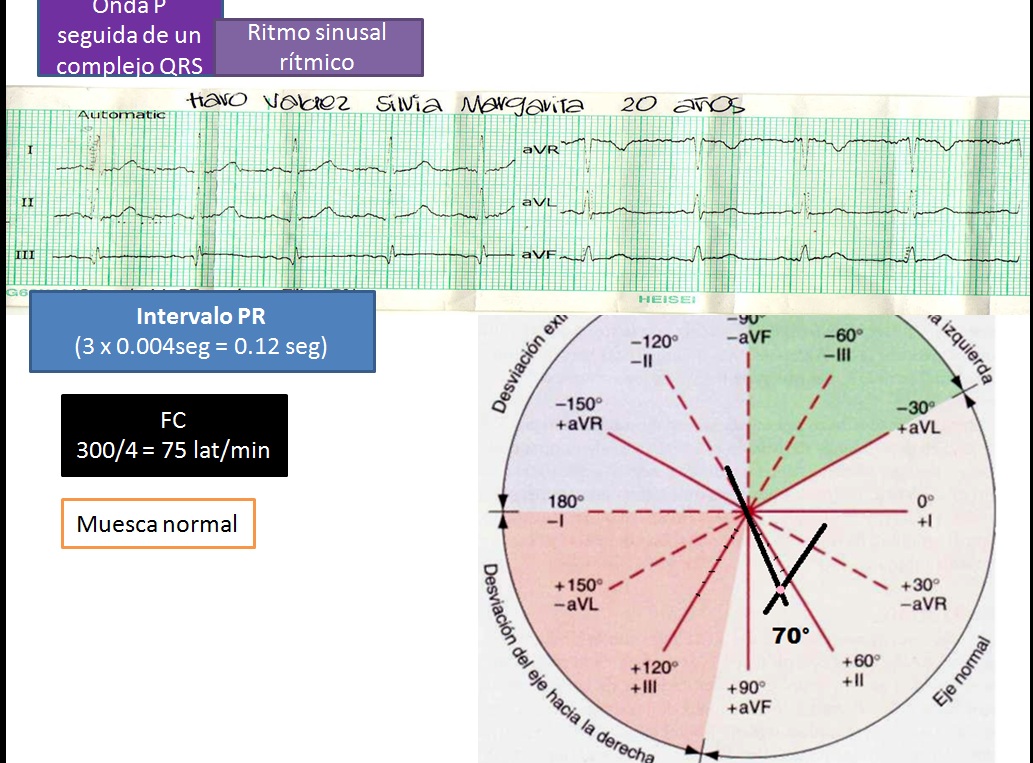 PORTAFOLIO DIGITAL DE EVIDENCIAS PARA EL APRENDIZAJE DE FISIOLOGÍA ...