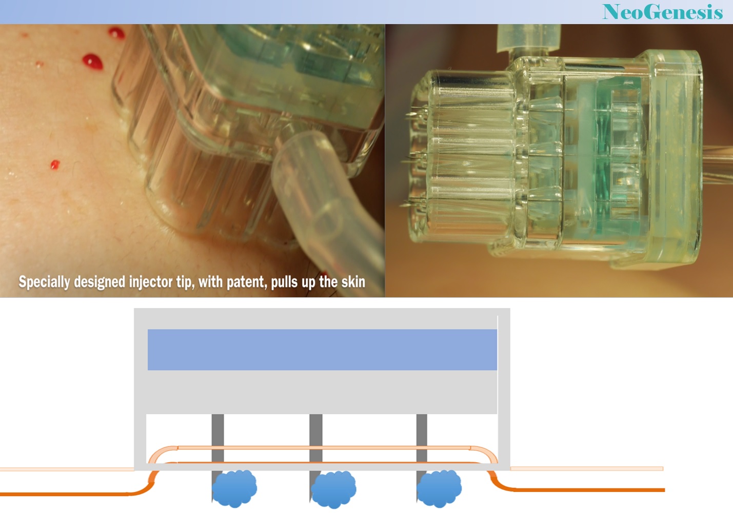 NeoGenesis - The Global Leader Enterprise of Diverse Cell Therapies