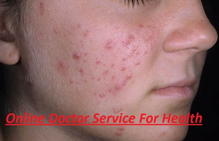 Online Doctor Service For Health: Treatment of Skin and soft tissue ...