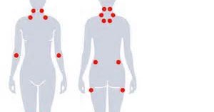 Chronic Leigh's Fibro Diary: Fibromyalgia 101: Tender Points