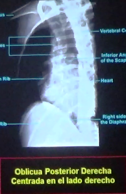 RADIOANATOMIA: CLASE 9