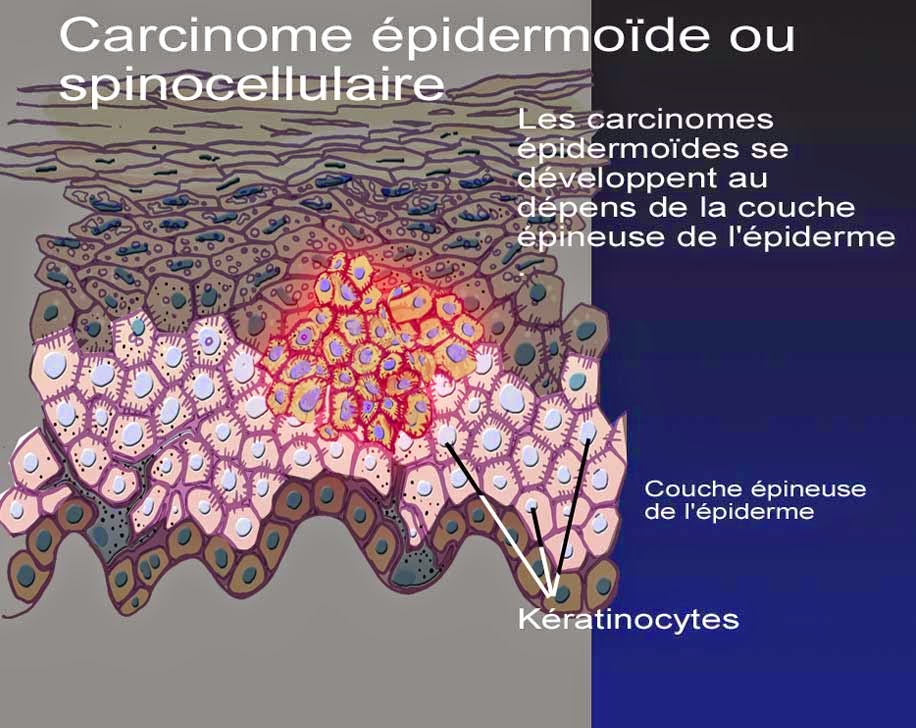 Actualités Scientifiques - Médicales: janvier 2015