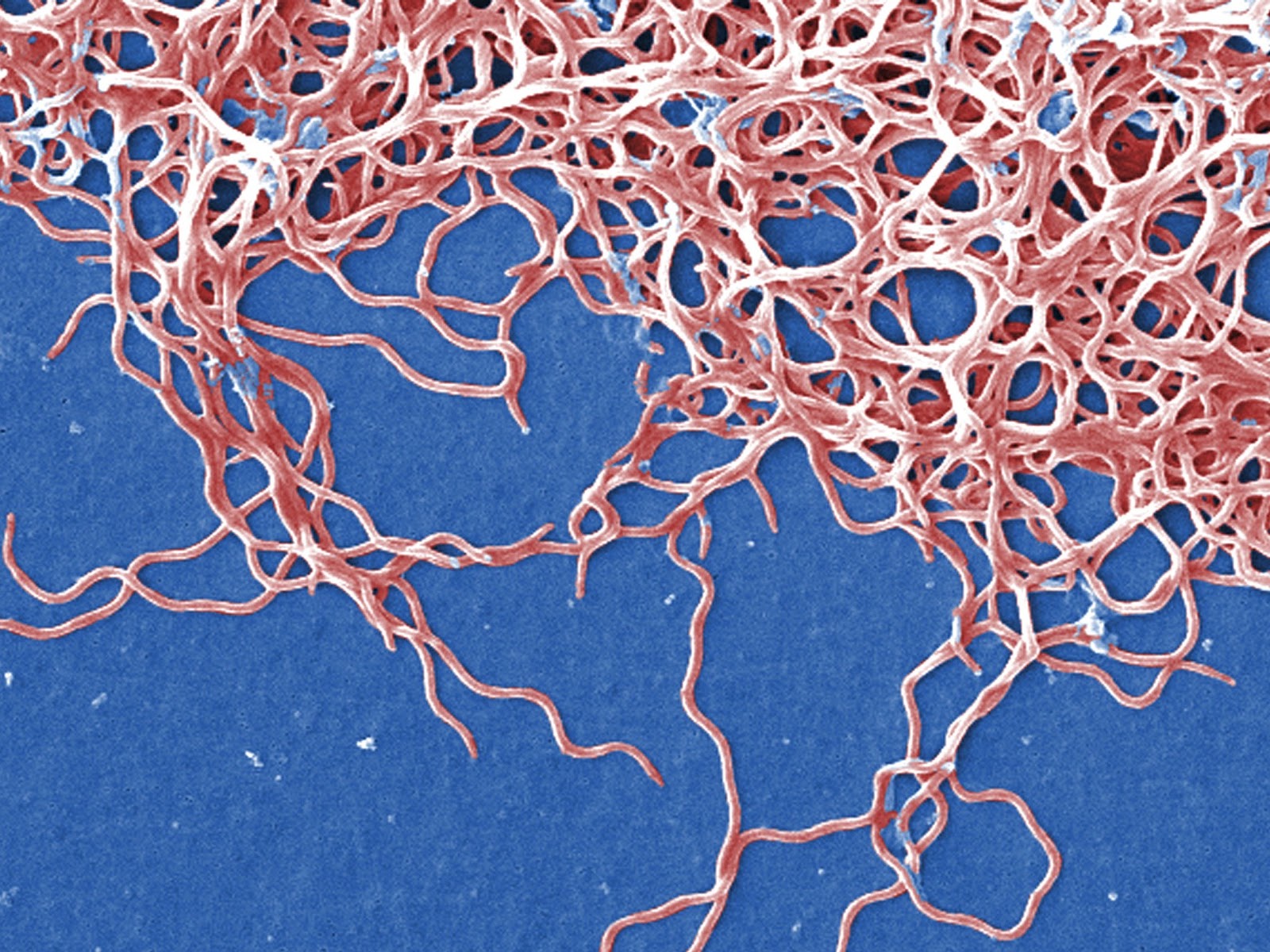 BIOMAGNETISMO ANTOFAGASTA -CHILE: Borrelia