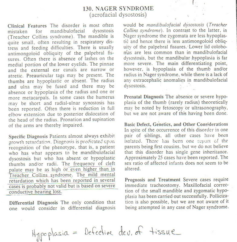 MissLilTazzy: Nager Syndrome