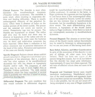 MissLilTazzy: Nager Syndrome