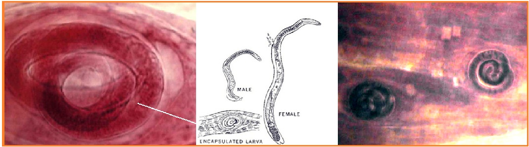 BIOLOGI GONZAGA: NEMATHELMINTHES-CACING GILIG