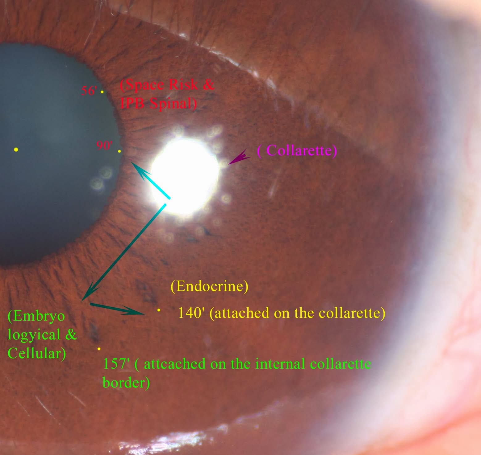 Modern & Multidimensional Iridology: The Integration of Iris Zones ...