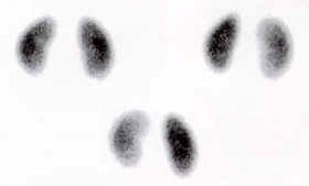 Nuclear pharmacy basics: Uses Of Radiopharmacology