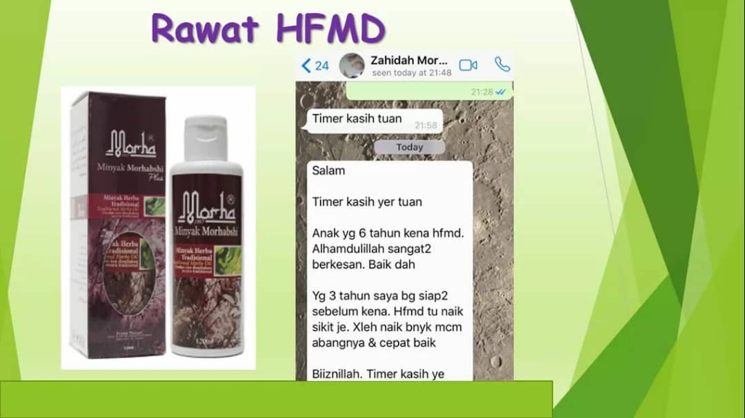 Dah ada Minyak Morha?: HFMD sakit tangan, Kaki, dan mulut