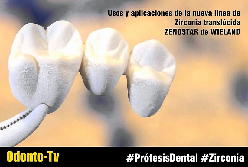 VIDEOCONFERENCIA: Usos y aplicaciones de la línea de Zirconia ...