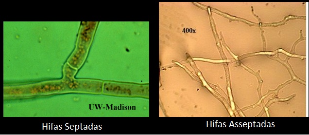 LFN321: Aula 6 - Fungos