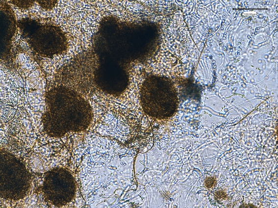 Fun With Microbiology (What's Buggin' You?): Phoma glomerata