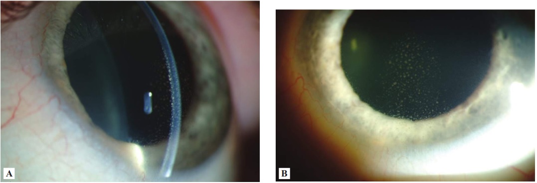 [Emergency] ATLAS OF ANTERIOR UVEITIS (IRITIS) | Free Medical Atlas