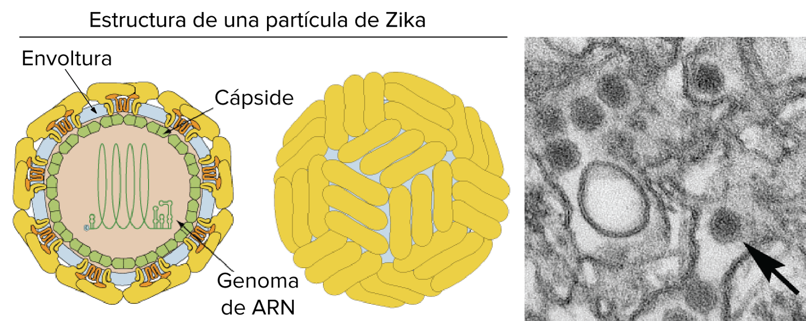 Estructura Del Virus De La Rubeola