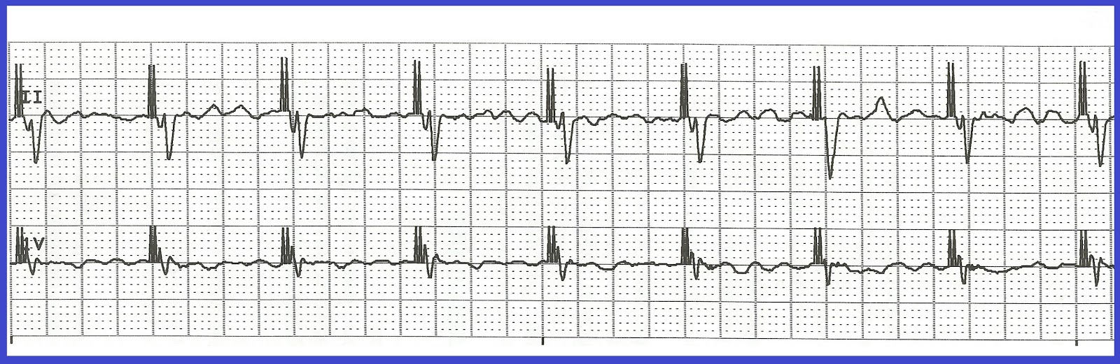 Paced Rhythms Quiz 296