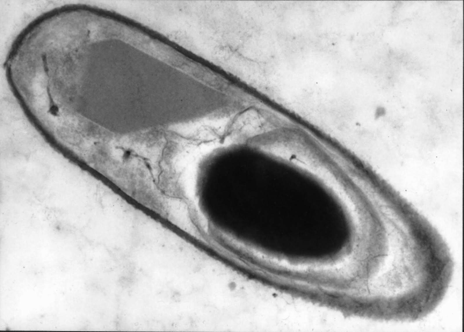 Approach to Disinfection and Sterilization: Factors Affecting the ...